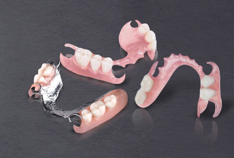 Valplast® Partials: Flexible and Comfortable Option